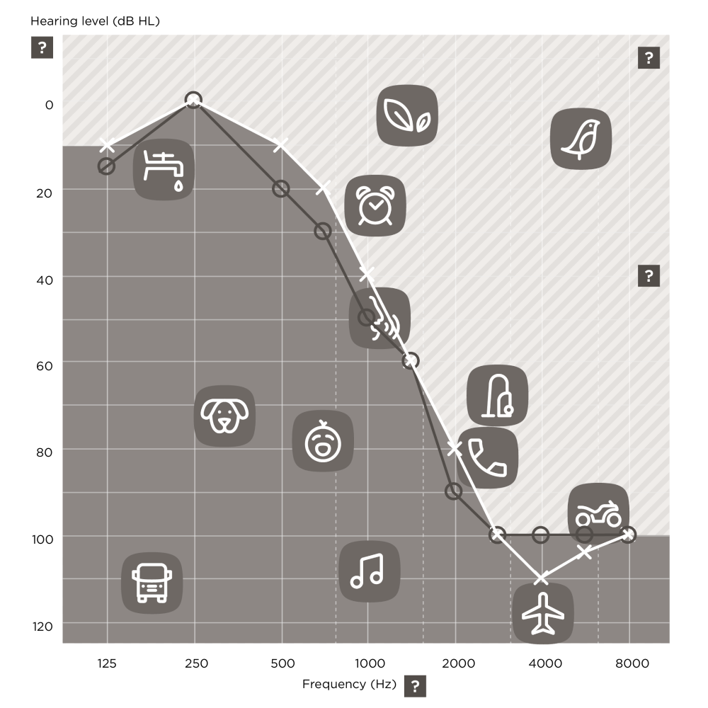The human hearing range - from birdsong to loud sounds